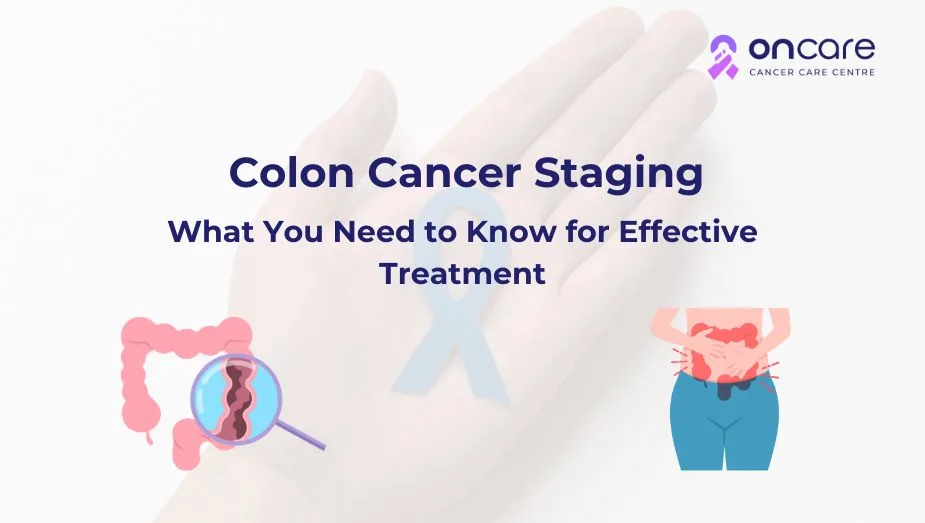 Colon cancer staging: Explore more about the treatments options