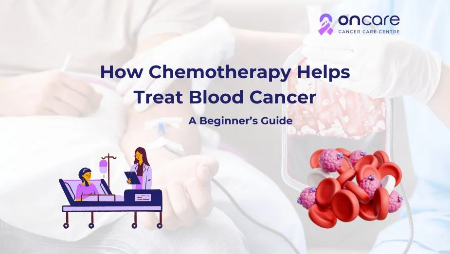 How chemotherapy helps to treat blood cancer patients