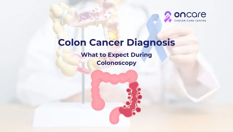 Colon Cancer Diagnosis: How to prepare for a Colonoscopy Process