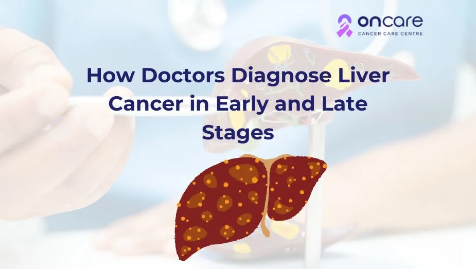 How doctors diagnose liver cancer in early and late stages!