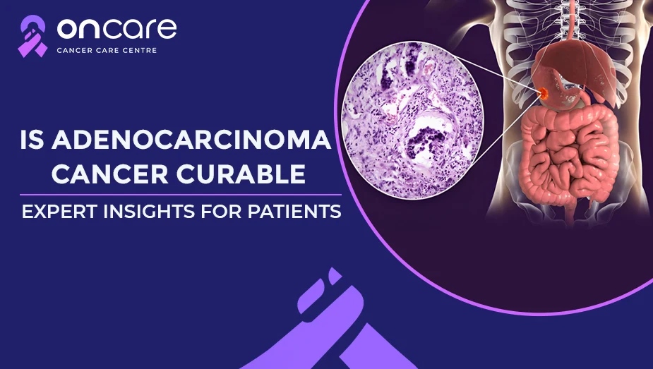 Is adenocarcinoma cancer curable, and factors affect its cure?