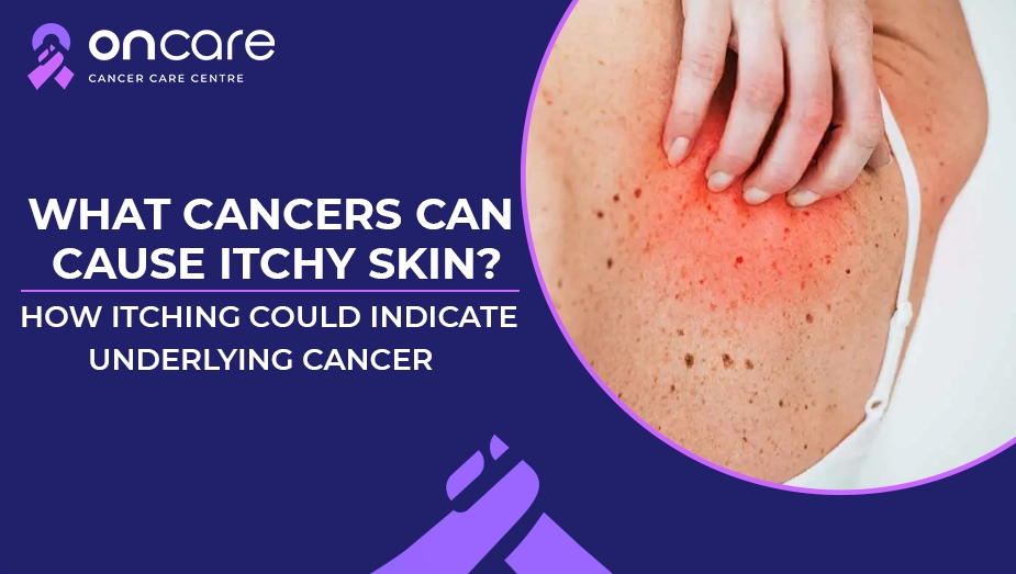 What Cancer Can Cause Itchy Skin? Causes, Signs & When to Worry