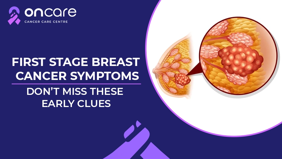 First Stage Breast Cancer Symptoms: Early Signs to Watch