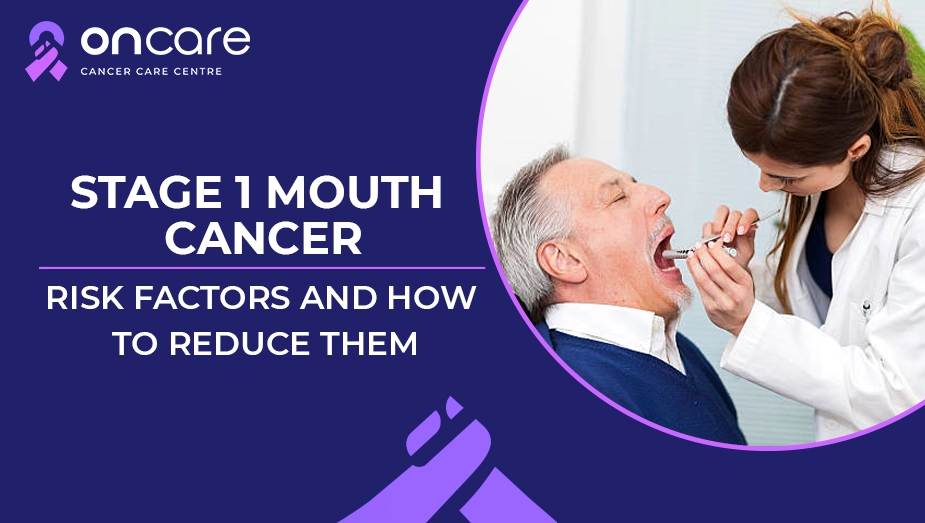 Stage 1 Mouth Cancer: Symptoms, Risks & Prevention Guide
