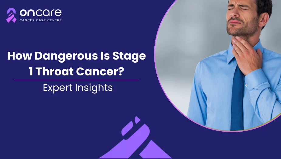 What is stage 1 throat cancer and how dangerous is this stage?