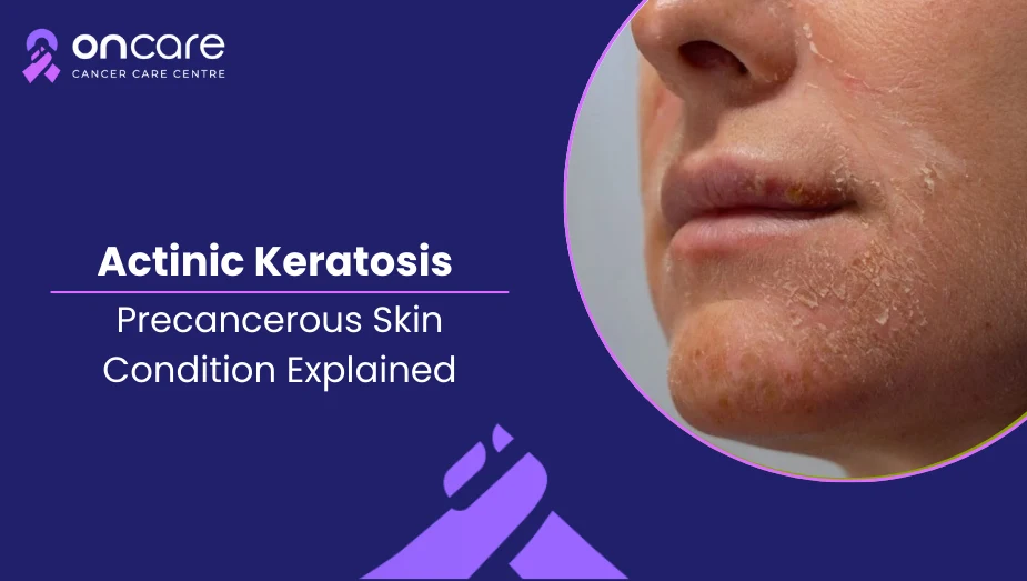 What is Actinic Keratosis and its signs and symptoms?
