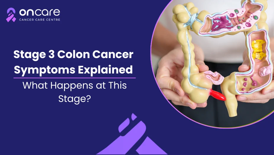 Stage 3 Colon Cancer Symptoms: Signs, Diagnosis, and Treatment Options