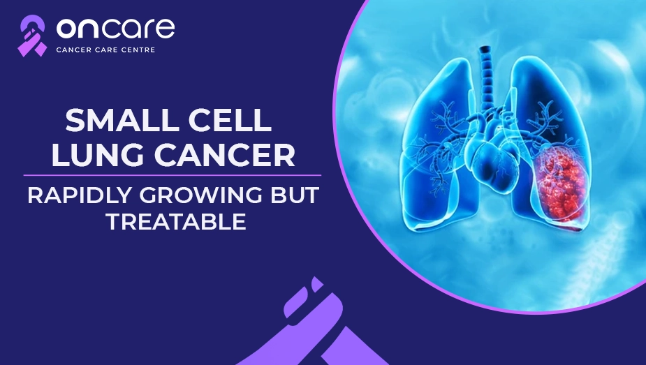 What is Small cell lung cancer and its treatment options?