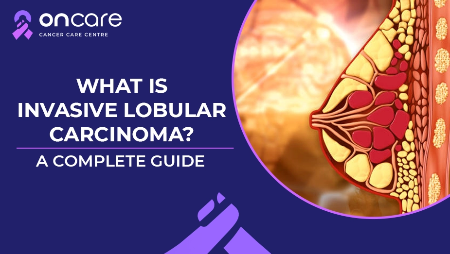 What is Invasive Lobular Carcinoma and its signs, treatments!
