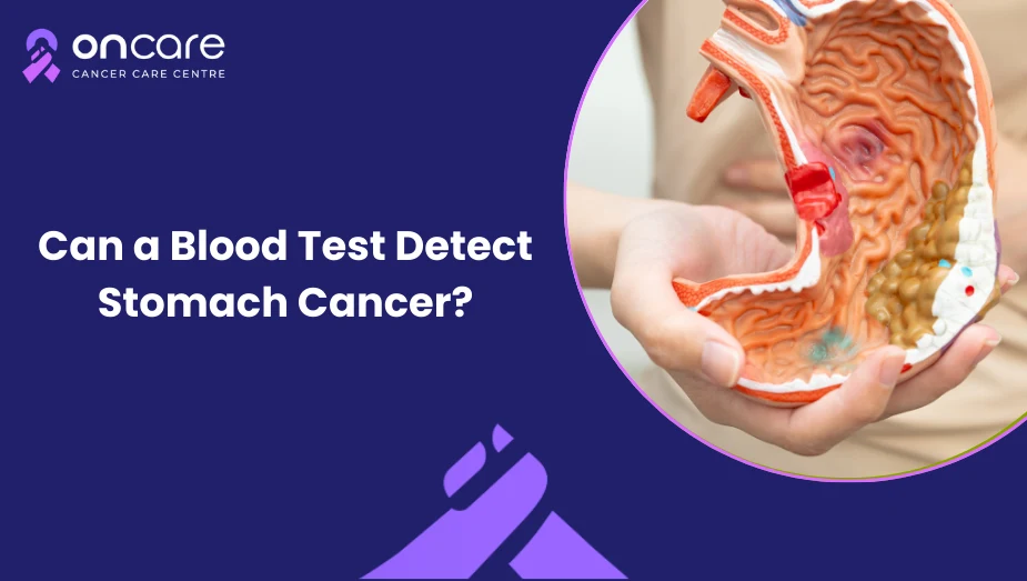 Can a Blood Test Detect Stomach Cancer? Tests and Diagnosis Explained