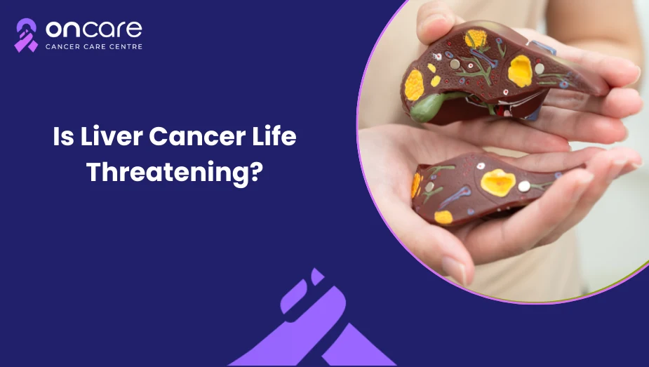 Is liver cancer deadly and life-threatening? Facts explained