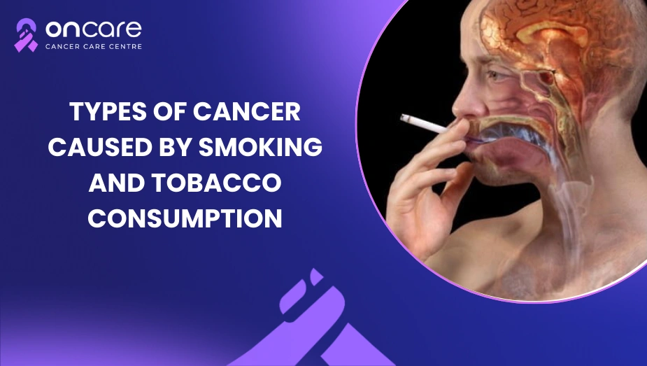 Types of Cancer Caused by Smoking: Risks & Facts | Oncare