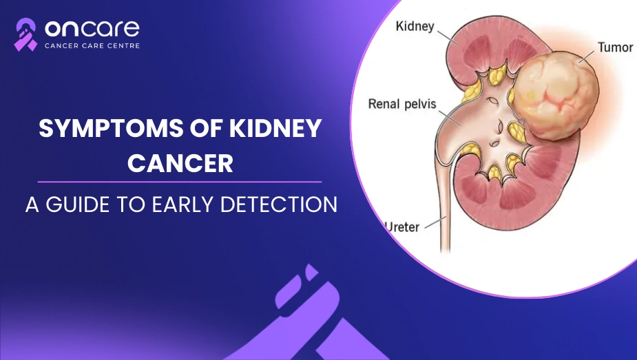 Kidney Cancer Symptoms: Blood in Urine & Pain | Oncare