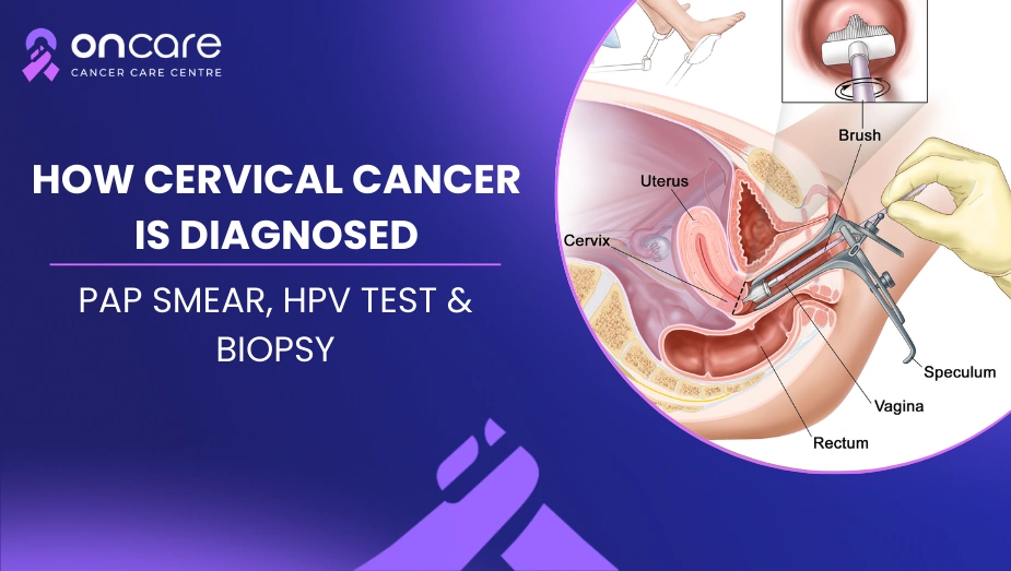 Cervical Cancer Diagnosis: Pap & HPV Tests | Oncare