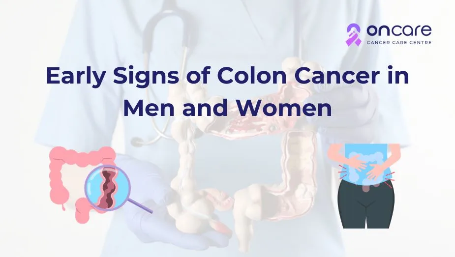Colon Cancer Survival Rate by Stage: Why Early Detection Saves Lives
