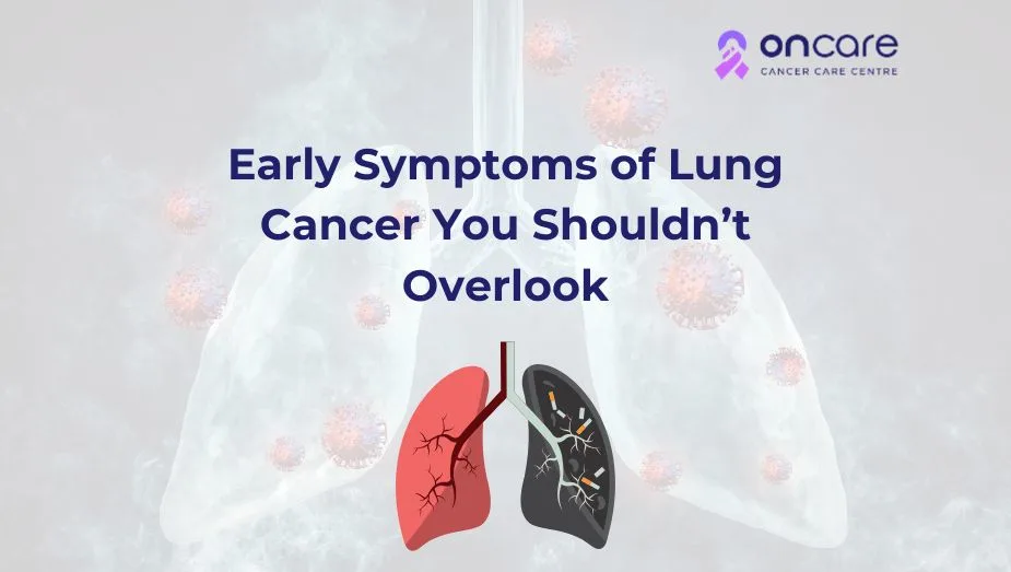 What are ICD codes for lung cancer and coding errors to avoid?