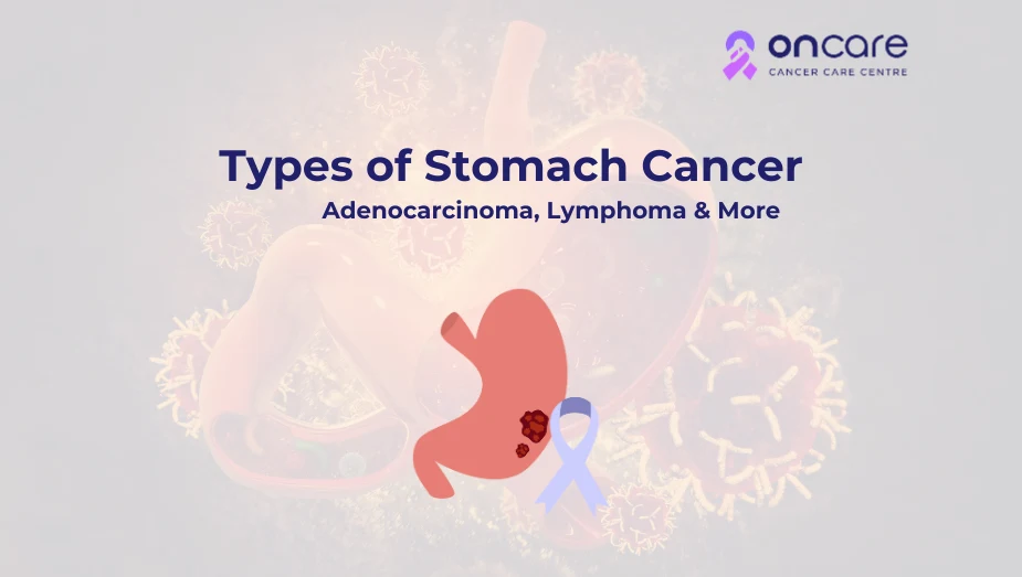 Types of Cancer Treatments: Choosing the Right Path to Recovery
