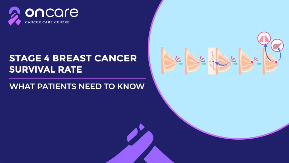 Stage 4 Cancer Symptoms: Early Signs and What to Watch For