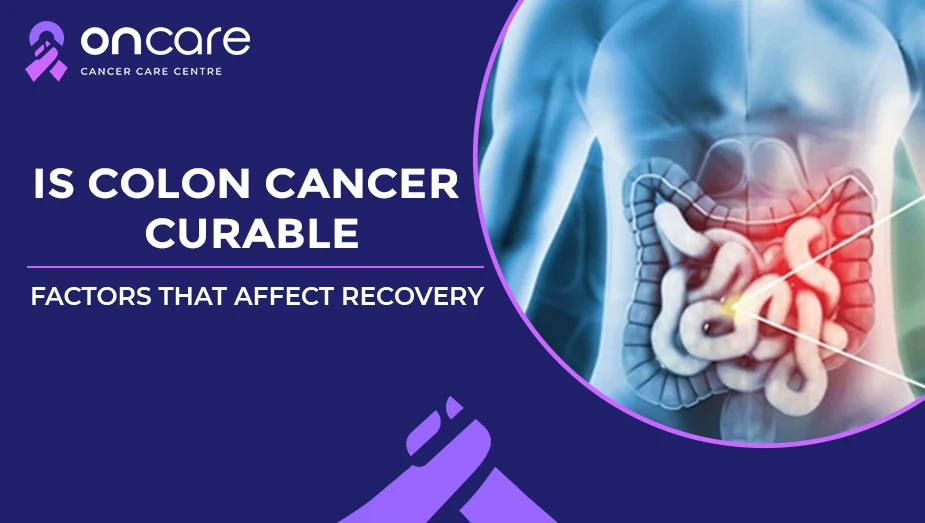 What Is Colon Cancer? Symptoms, Causes, Risks & Early Detection