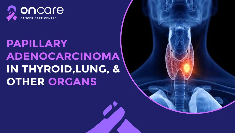 What are the types of thyroid cancer and its treatment options?