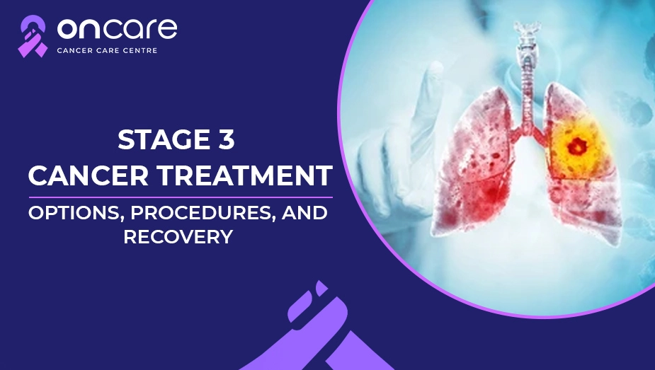 What is stage 2 cancer treatment, options and outlook!