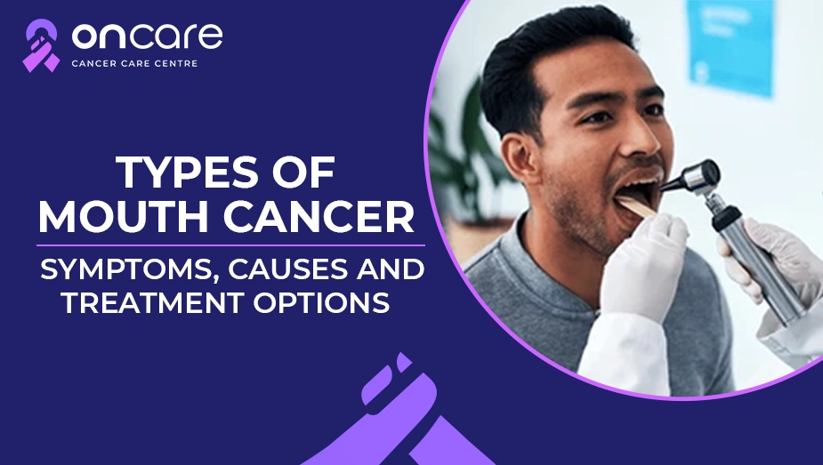 What are the treatments for mouth cancer, and how do they work?