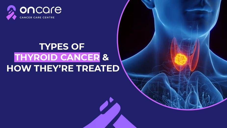 Early Signs of Thyroid Cancer: First Symptoms You Should Not Ignore