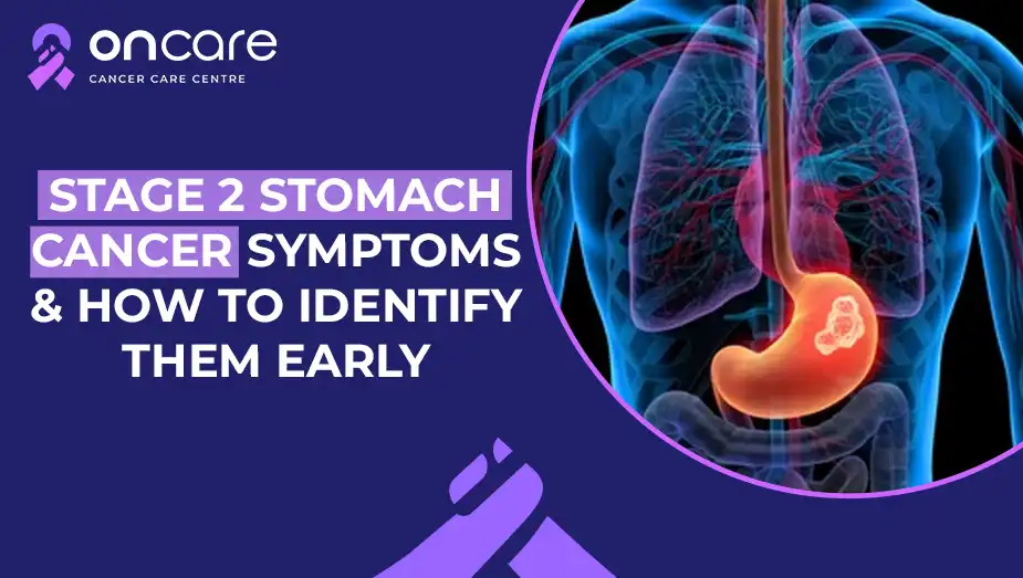 Stage 2 Stomach Cancer: Symptoms, Treatment, and Recovery Guide