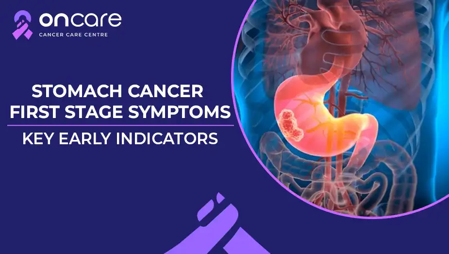 Stage 3 Stomach Cancer Survival Rate: Key Facts and Outlook