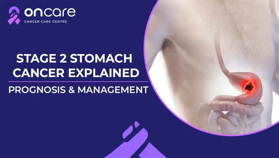 Stage 4 Stomach Cancer Treatment: Options, Care, and What to Expect