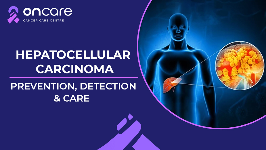 What is Hypopharyngeal Cancer and its symptoms and treatments?
