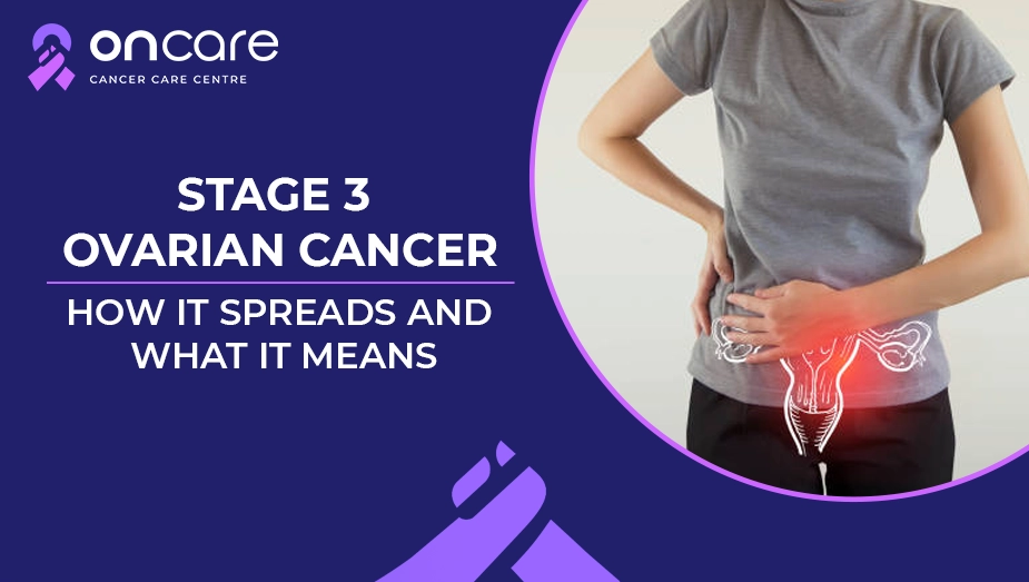 What is stage 4 throat cancer, and its symptoms and treatments?