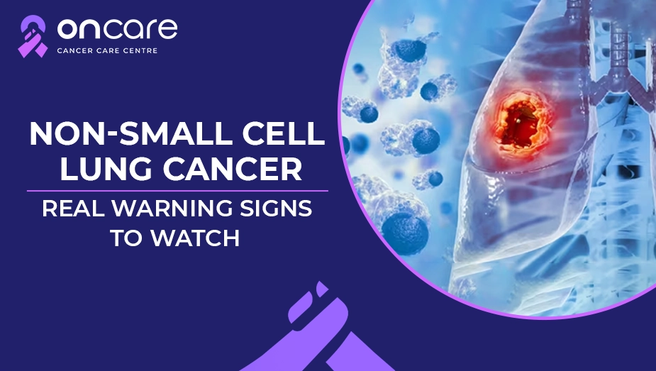 Stage 4 lung cancer: ways to manage its advanced symptoms