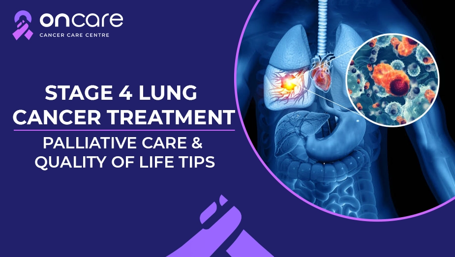 Stage 1 vs Stage 4 Cancer: Treatment & Outlook | Oncare