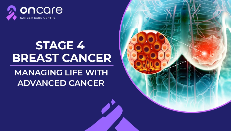 Stage 1 vs Stage 4 Cancer: Treatment & Outlook | Oncare