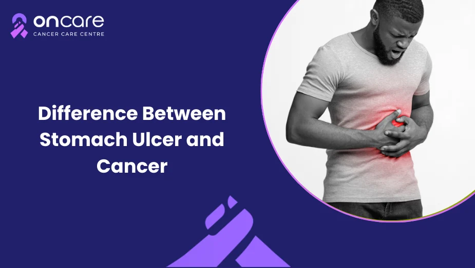 Stomach Cancer Symptoms: What to Look for Early | Oncare