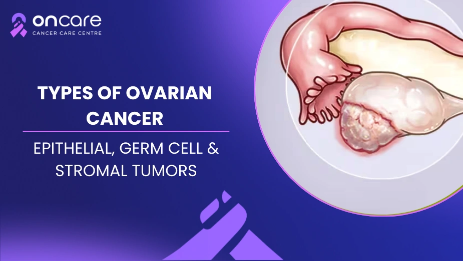 How to Check for Ovarian Cancer at Home: Signs Women Should Monitor