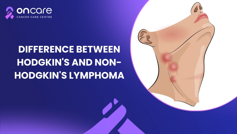 Is Lymphoma Curable? Understanding Types & Treatments
