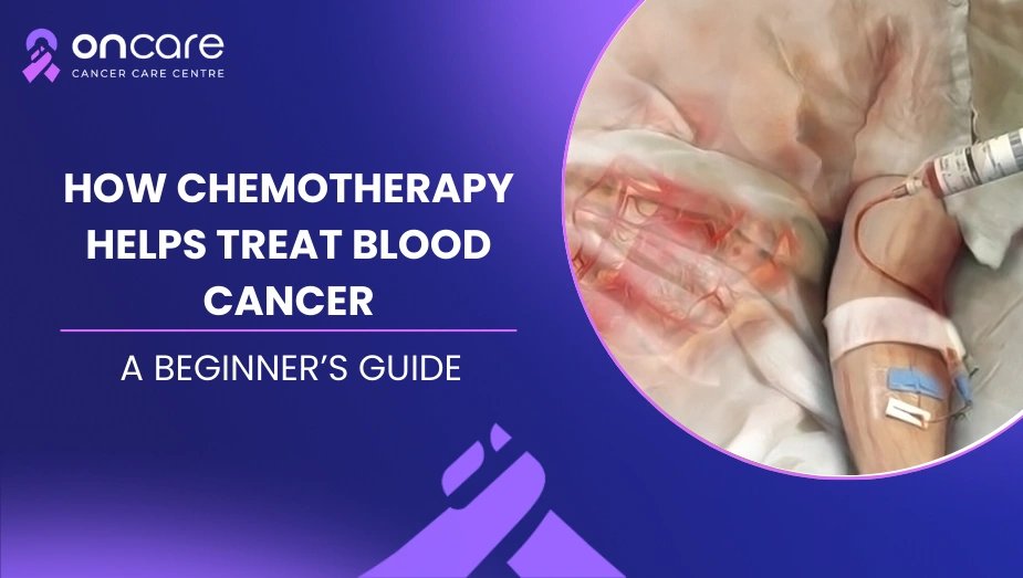 Radiation vs Chemotherapy: What Every Patient Must Know