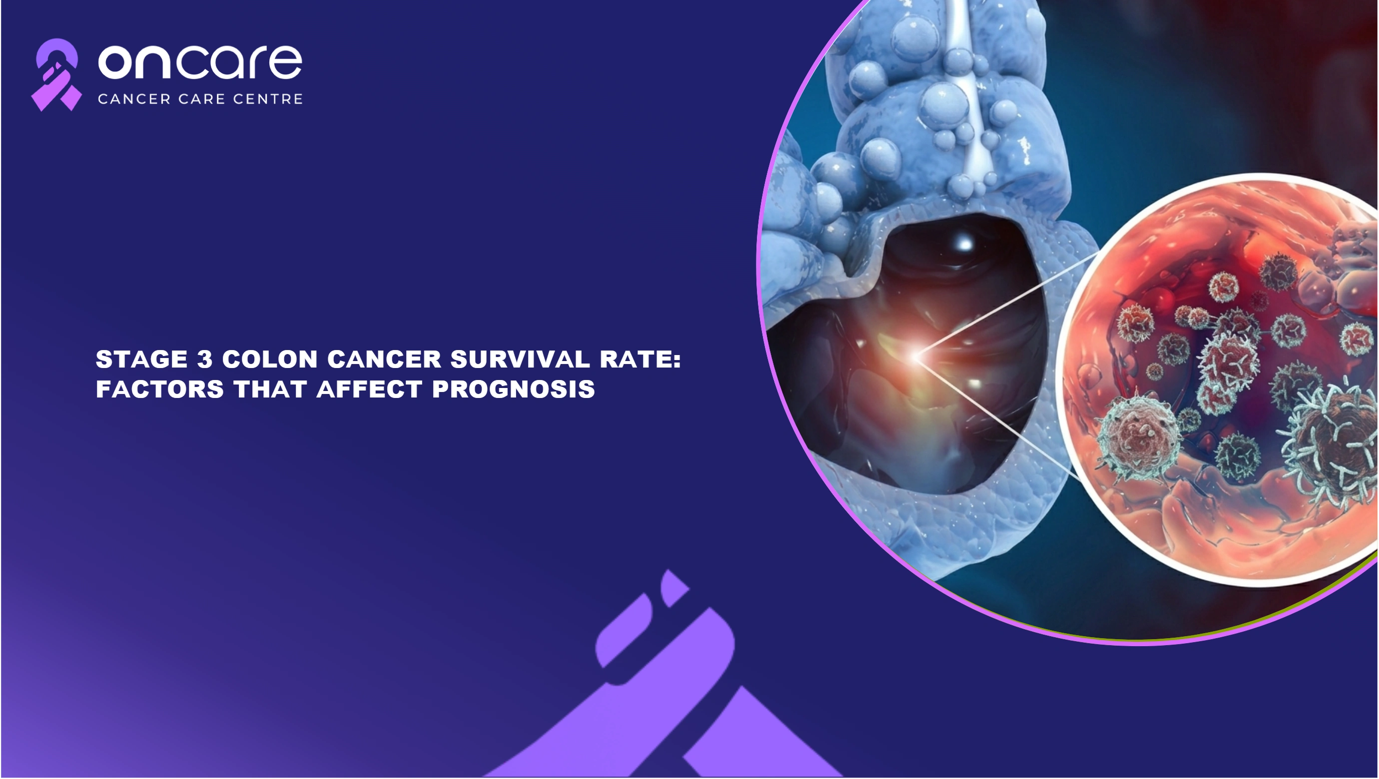 Stage 3 Cervical Cancer Treatment Options & Recovery | Oncare